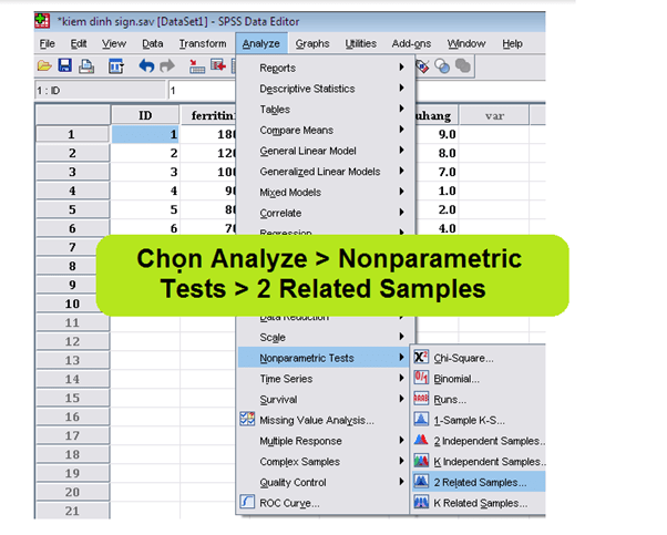 Giải thích và hướng dẫn tiến hành kiểm định wilcoxon trong SPSS